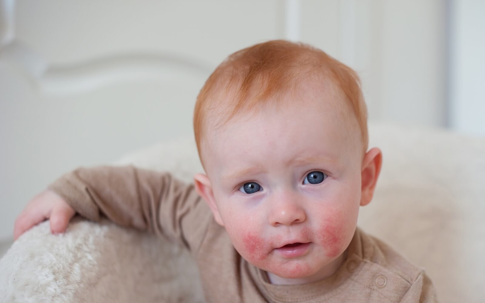 Managing Baby Allergies and Sensitivities 2026: A Parent’s Essential ...